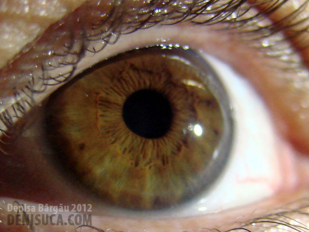 Ochiul uman, de aproape – Denisa Bârgău